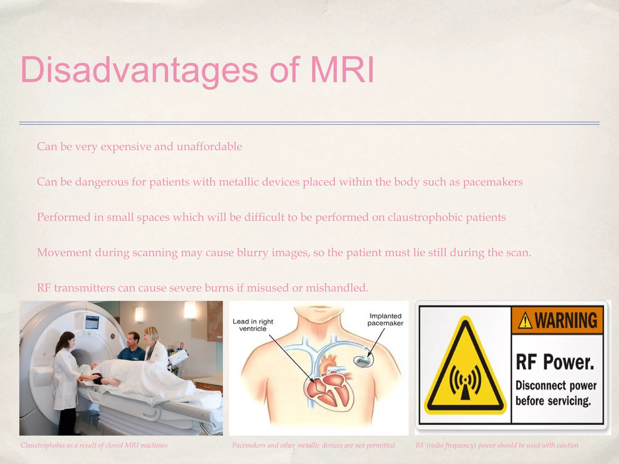 MRI Presentation Final | PPT