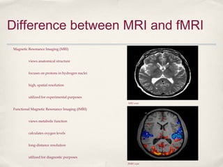 MRI Presentation Final | PPT