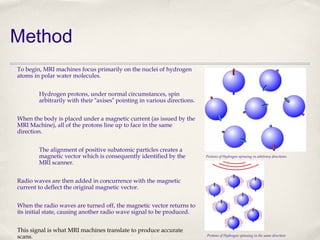 MRI Presentation Final | PPT