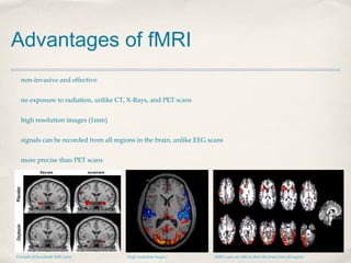 MRI Presentation Final | PPT