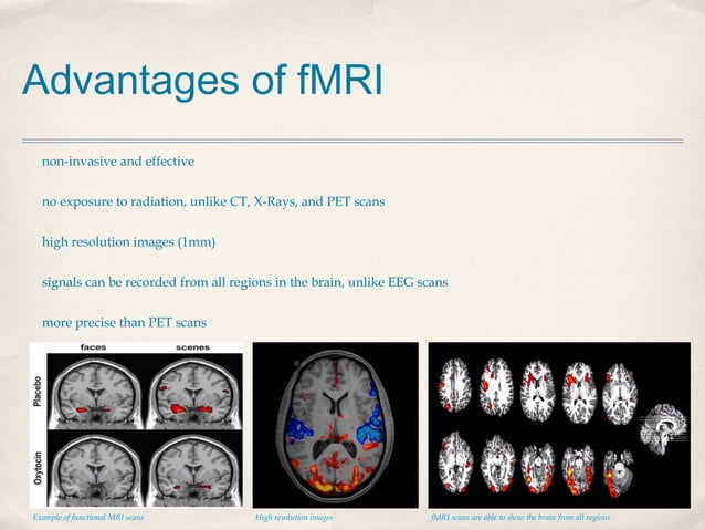 MRI Presentation Final | PPT