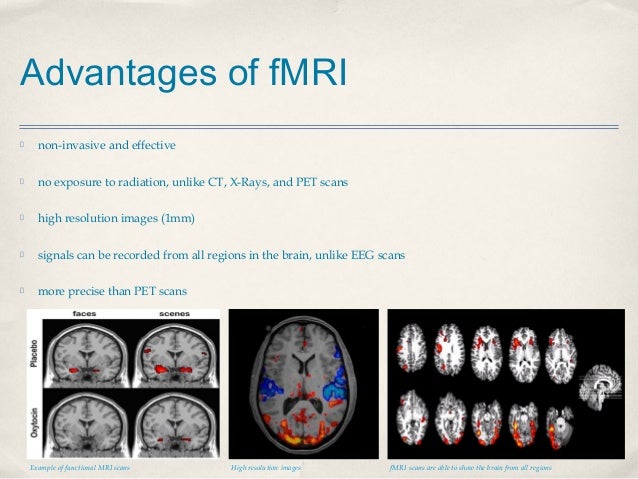 Disadvantages Of Fmri | fMRI (Functional MRI): What It Is, Purpose ...