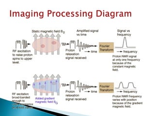 Mri presentation main | PPT