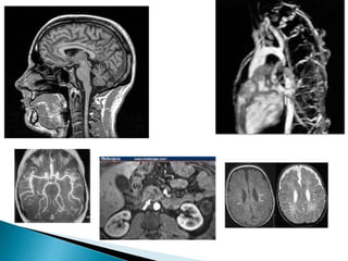 Mri presentation main | PPT