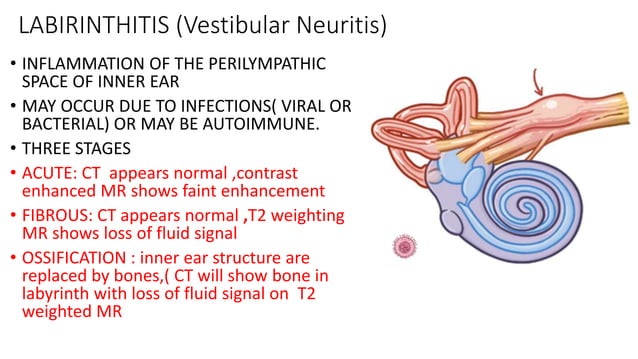 Mri procedure of INTERNAL ACOSTIC MEATUS | PPTX | Ear, Nose and Throat ...