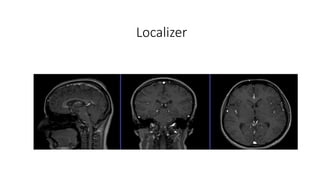 Mri procedure of INTERNAL ACOSTIC MEATUS | PPTX