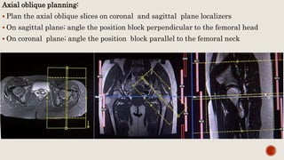 MRI procedure of pelvis and hip suman duwal | PPTX