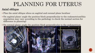 Pelvic Mri Procedure