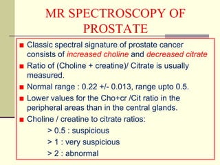 Mri prostate | PPTX