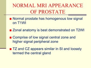 Mri prostate | PPTX