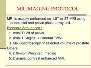 Mri prostate | PPTX