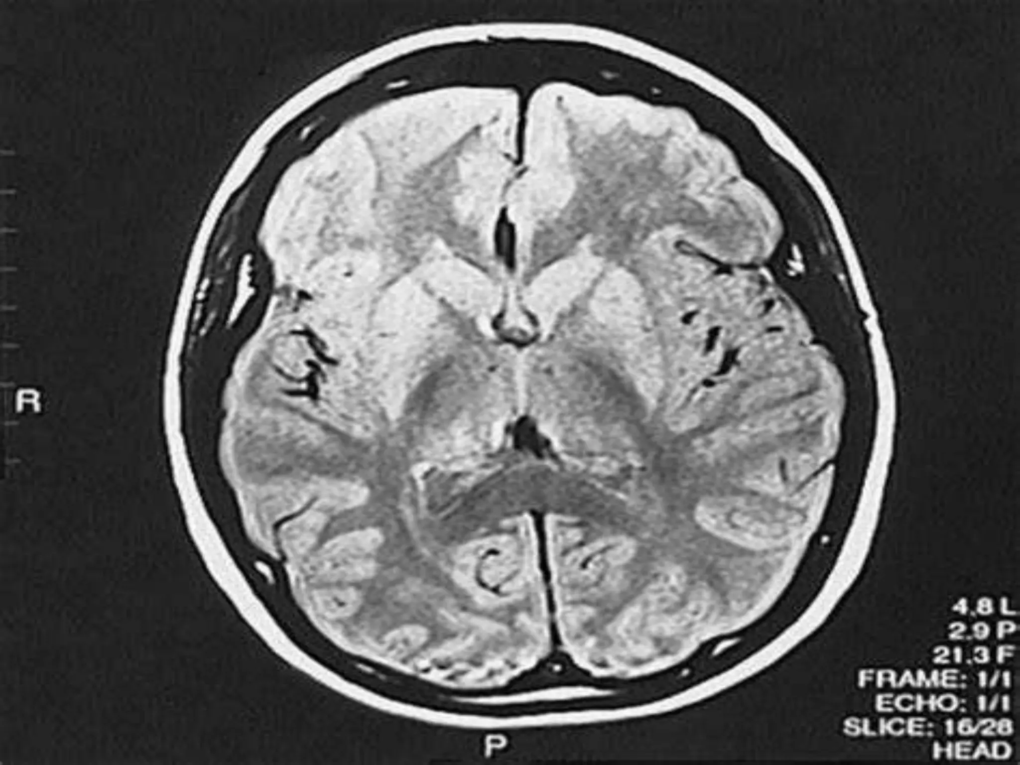 MRI PULSE SEQUENCE.pptx