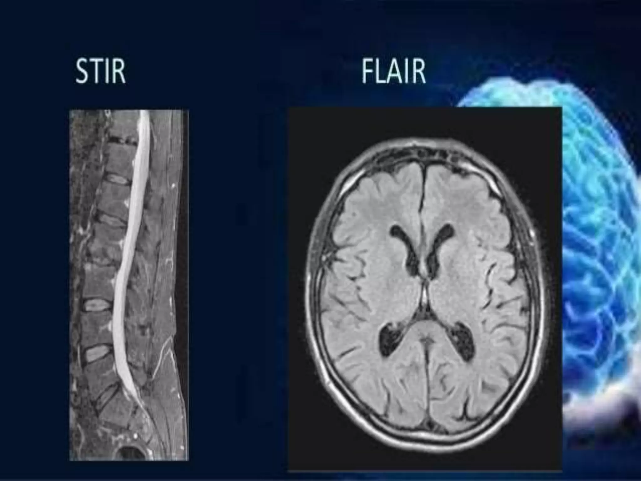 MRI PULSE SEQUENCE.pptx