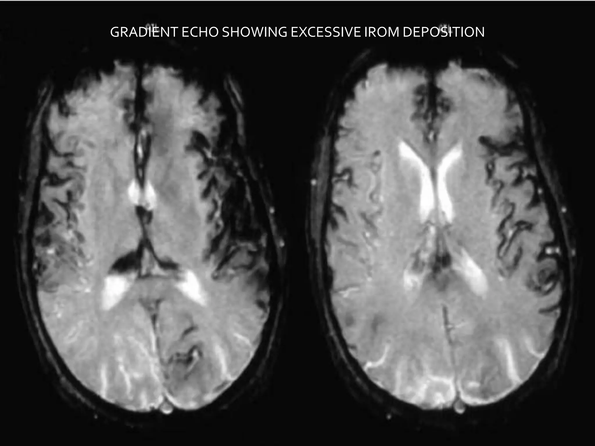 MRI PULSE SEQUENCE.pptx