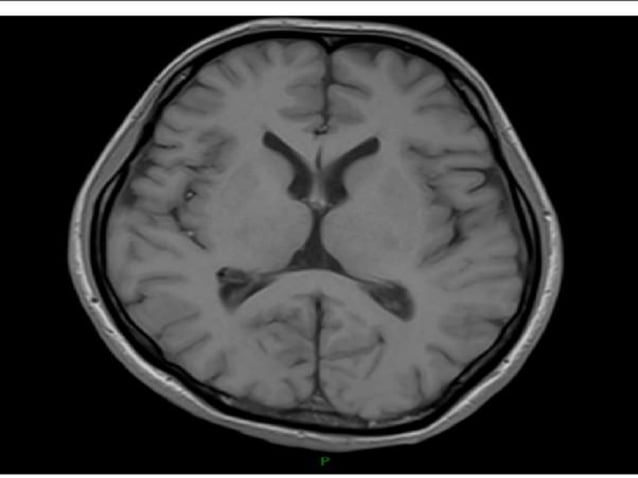 MRI PULSE SEQUENCE.pptx | Blood Disorders | Diseases and Conditions