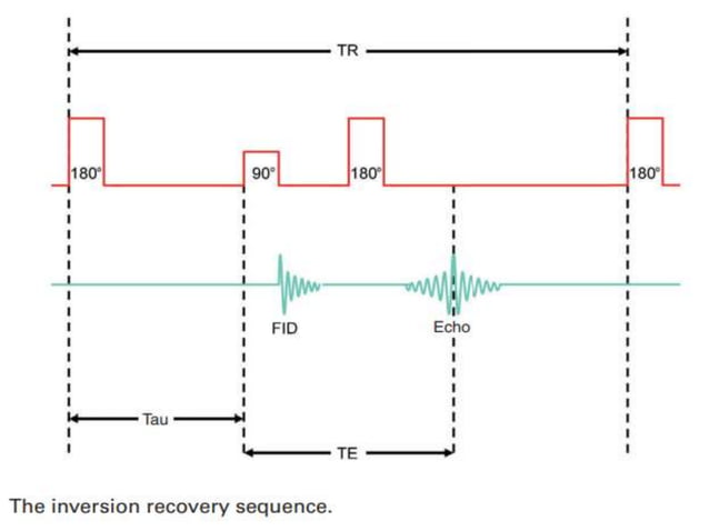 MRI PULSE SEQUENCE.pptx | Blood Disorders | Diseases and Conditions