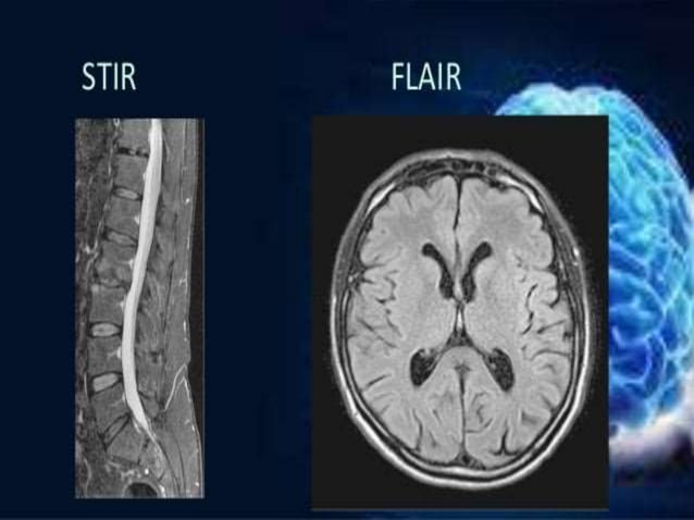 MRI PULSE SEQUENCE.pptx | Blood Disorders | Diseases and Conditions