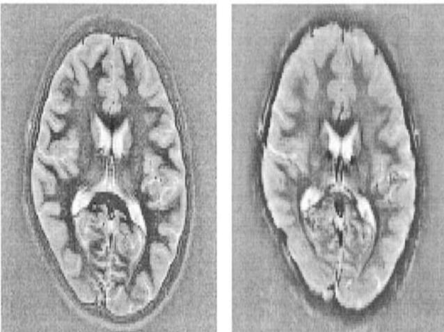 MRI PULSE SEQUENCE.pptx | Blood Disorders | Diseases and Conditions