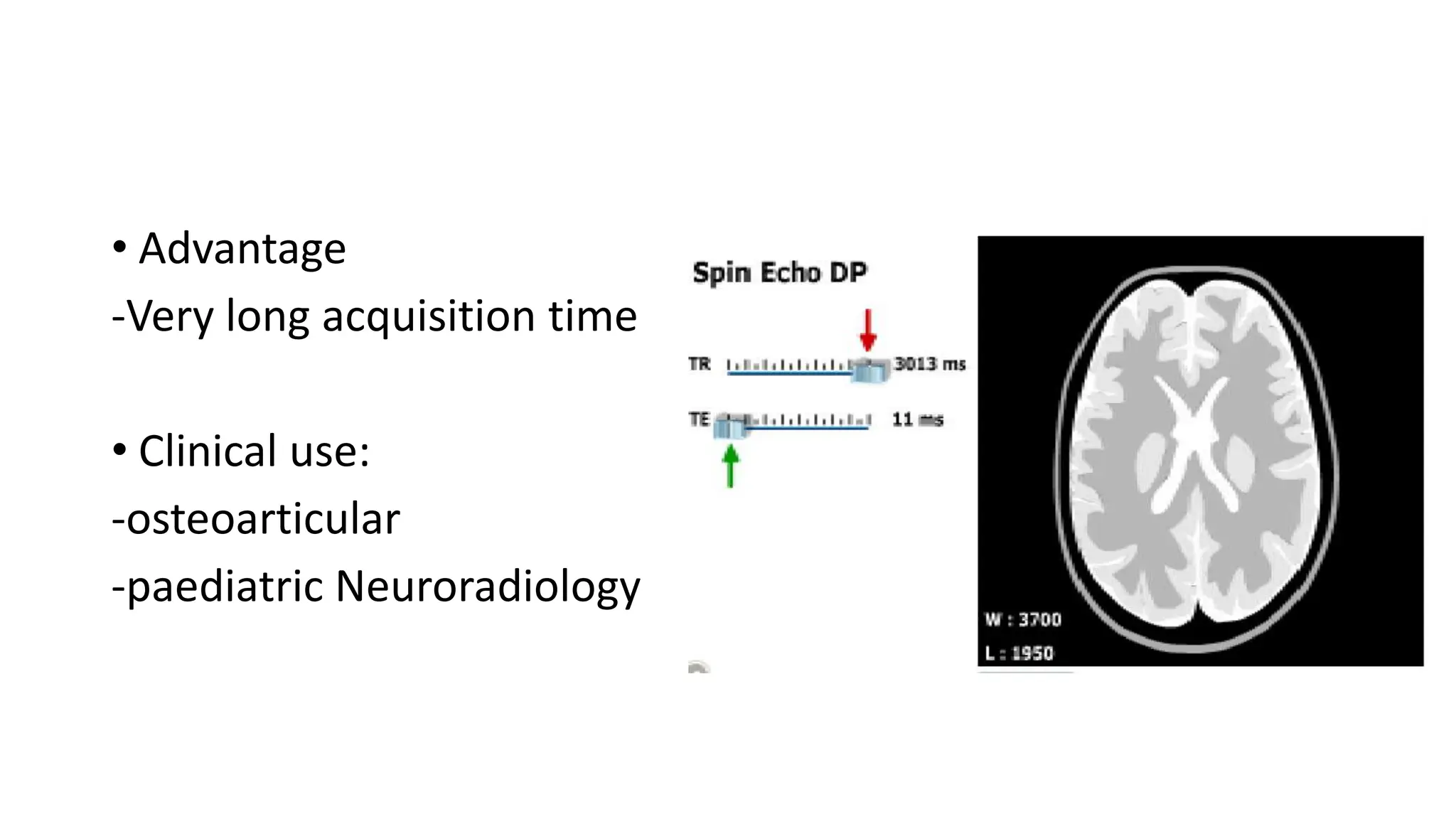 MRI PULSE SEQUENCES.pptx///////////////// | PPTX | Medical Tests ...