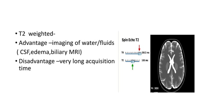 MRI PULSE SEQUENCES.pptx///////////////// | PPTX | Medical Tests ...