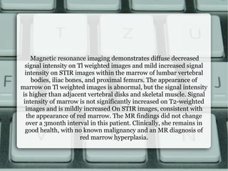 MRI-Spine/Pelvis-Case_Study | ODP