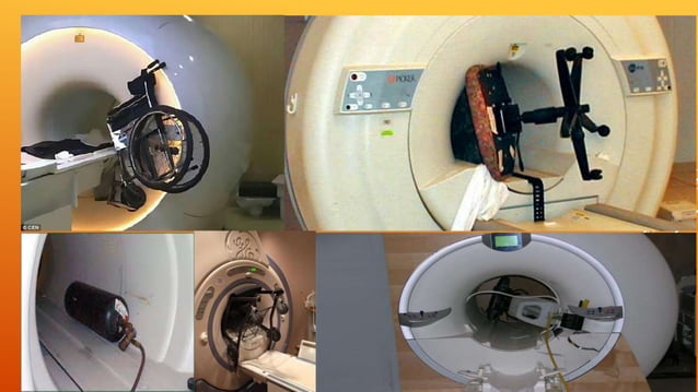 Mri safety | PPTX | First Aid | Injuries