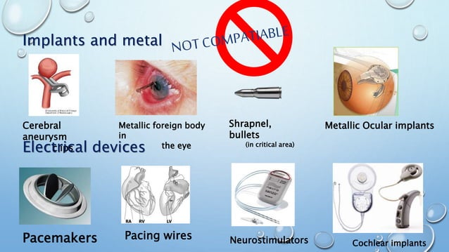 MRI Safety Basics | PPTX