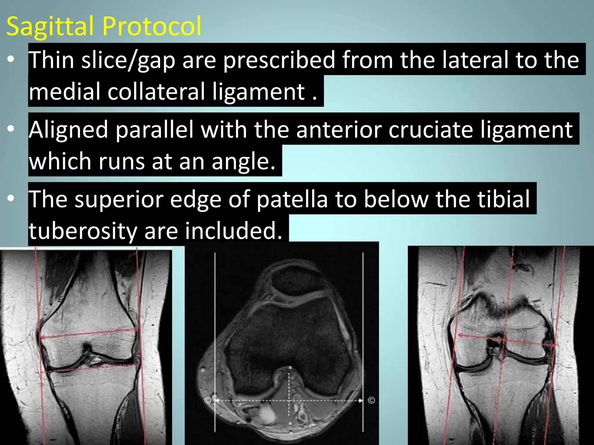 MRI shoulder and knee- Anatomy, Scan Planning & Its Techniques | PPTX