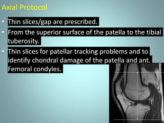 MRI shoulder and knee- Anatomy, Scan Planning & Its Techniques | PPTX