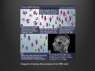 Mri scan | PPTX