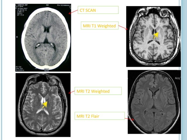 MRI sequences | PPT | Physics | Science