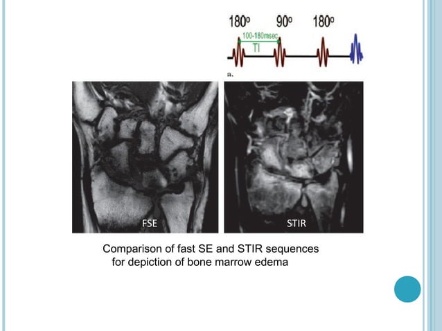 MRI sequences | PPT | Physics | Science
