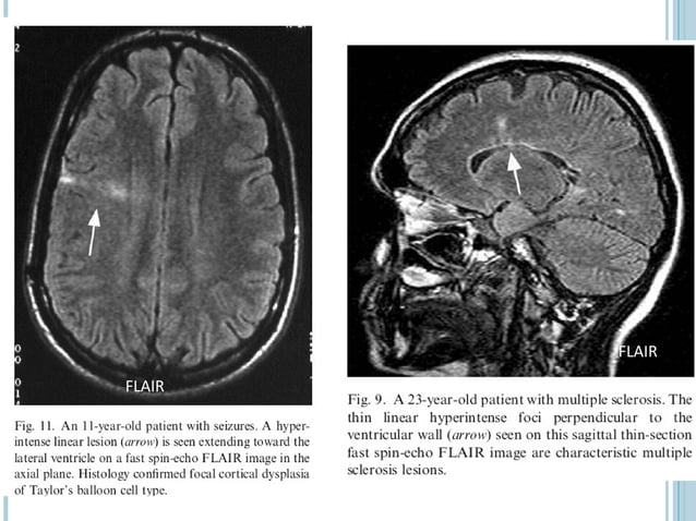 MRI sequences | PPT | Physics | Science