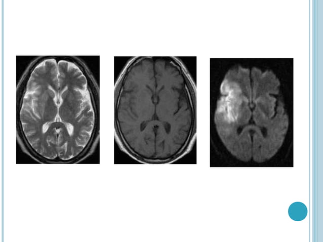 MRI sequences | PPT | Physics | Science