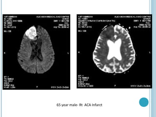 MRI sequences | PPT