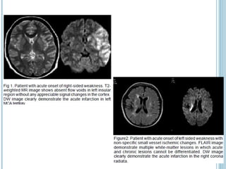 MRI sequences | PPT