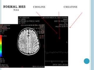 MRI sequences | PPT