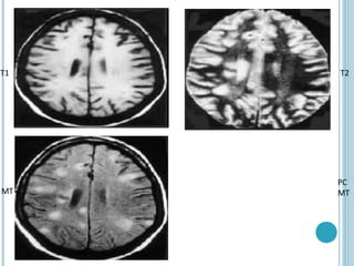 MRI sequences | PPT