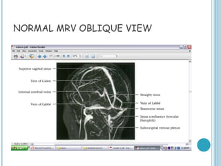 MRI sequences | PPT