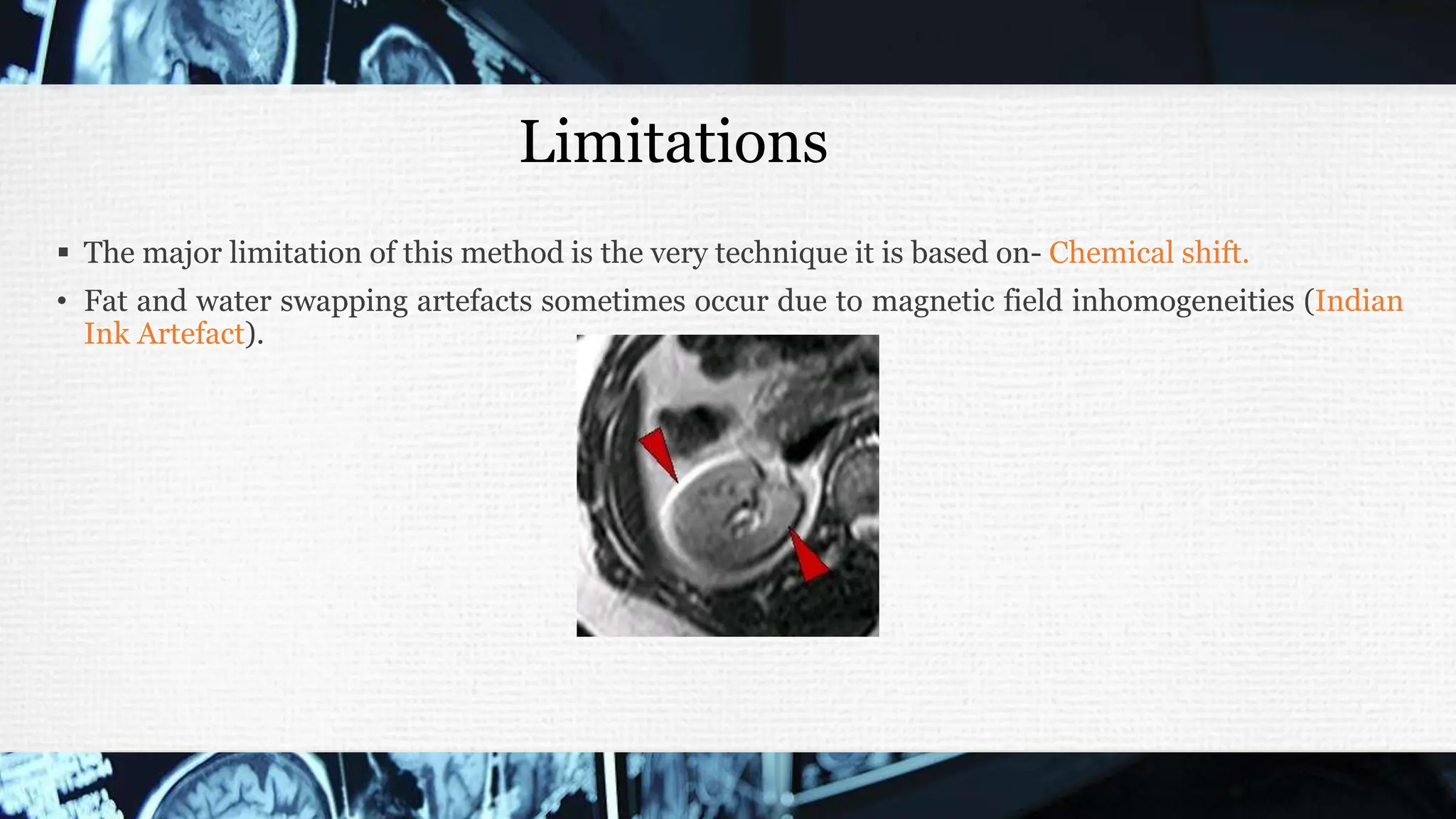 MRI physics: The Dixon Technique . Tech Explainations | PPTX