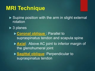 MRI of the shoulder | PPTX