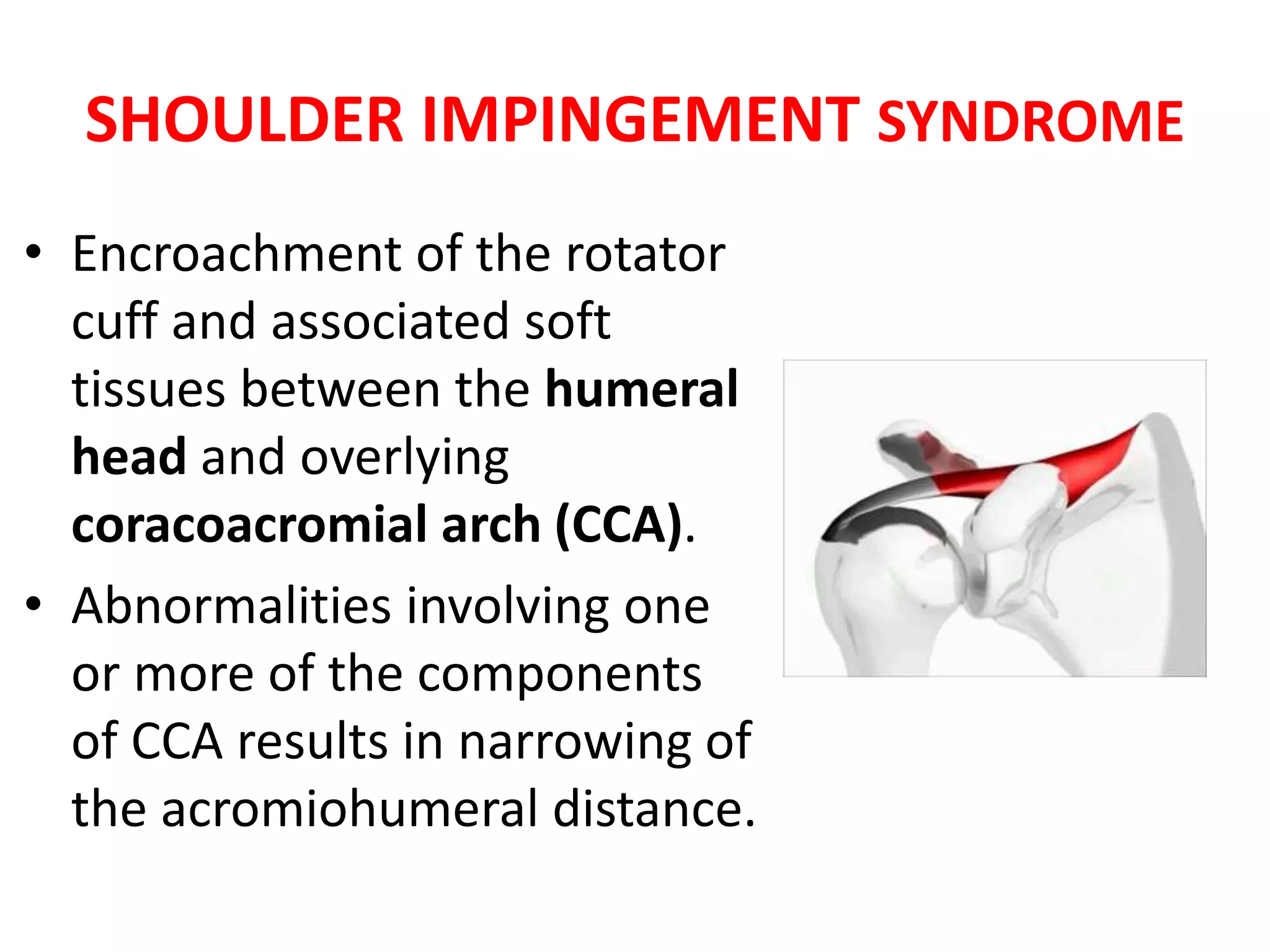 Mri shoulder joint with common pathologies | PPTX