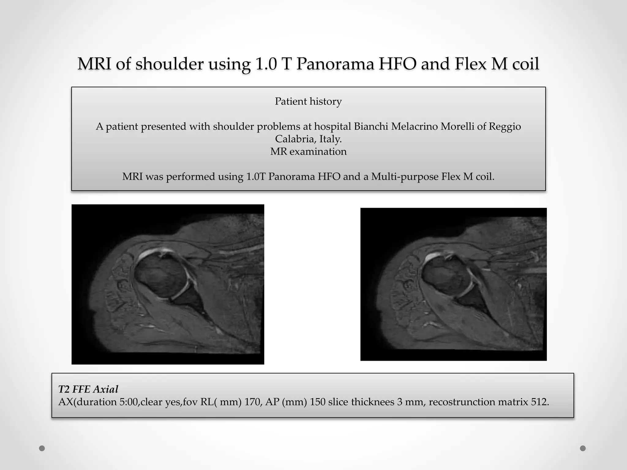 Mri shoulder coil flex 1 channel open MRI,executed by Giuseppe ...