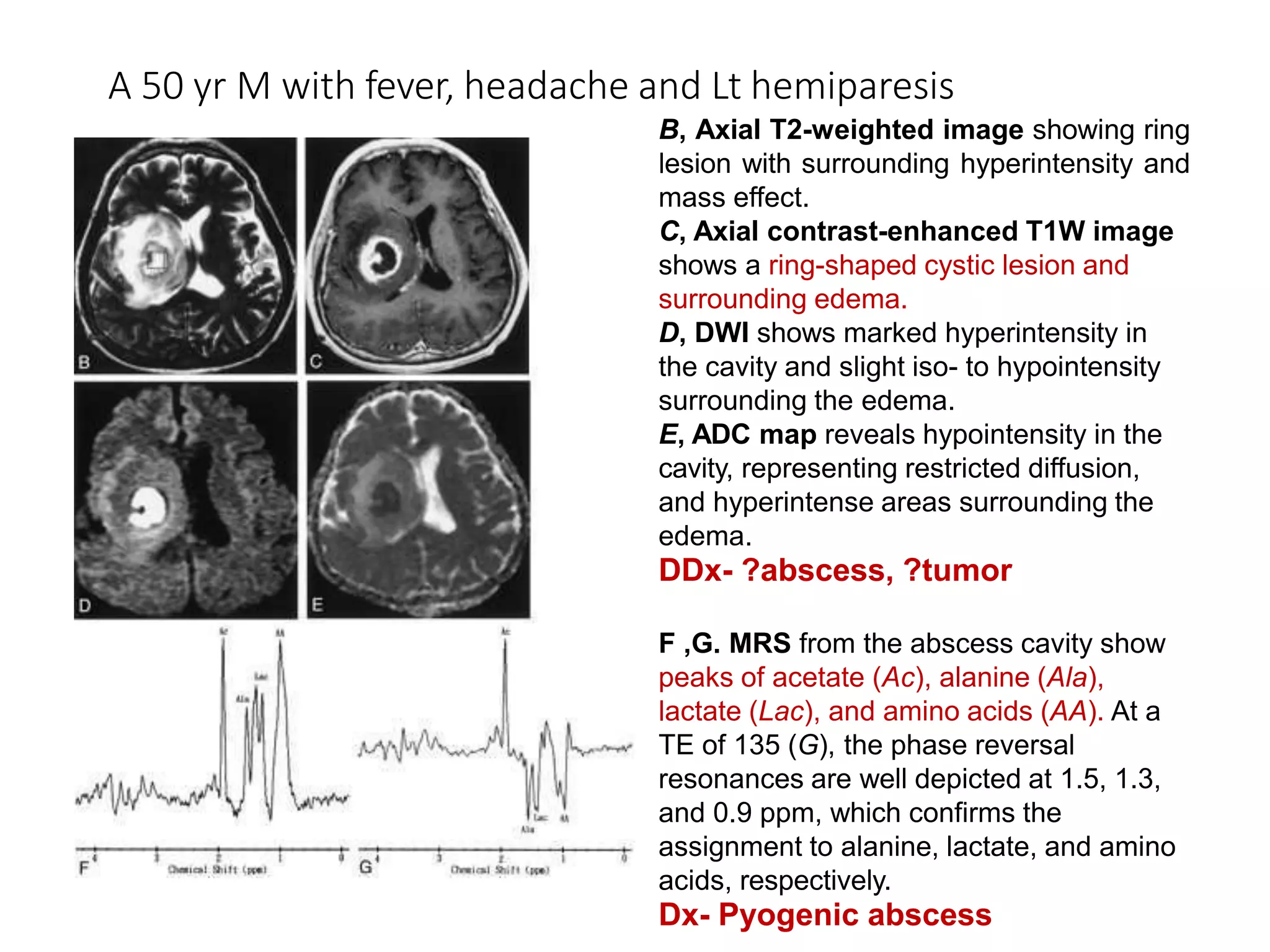 MRI spectroscopy- Its Application, Principle & Techniques | PPTX ...