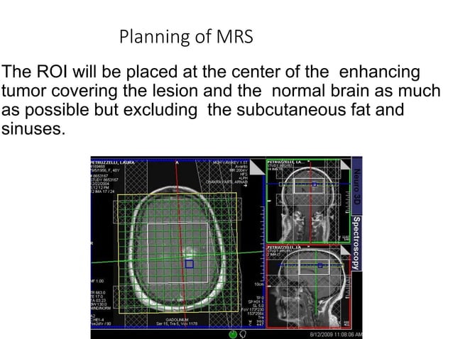 MRI spectroscopy- Its Application, Principle & Techniques | PPTX ...