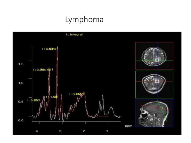 MRI spectroscopy- Its Application, Principle & Techniques | PPTX ...