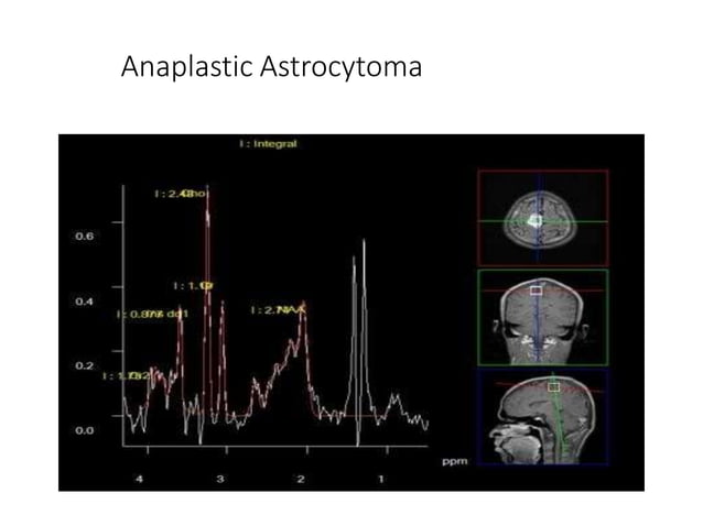 MRI spectroscopy- Its Application, Principle & Techniques | PPTX ...