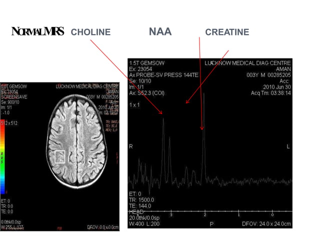 MRI spectroscopy- Its Application, Principle & Techniques | PPTX ...