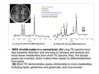 MRI spectroscopy- Its Application, Principle & Techniques | PPTX