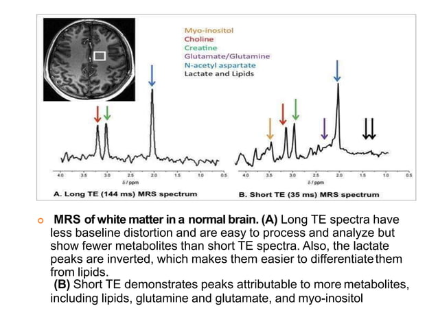 MRI spectroscopy- Its Application, Principle & Techniques | PPTX ...